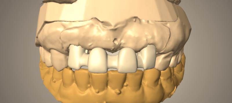 CAD DESIGN – CEBU DENTAS INTERNATIONAL INC.