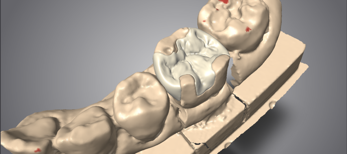 CAD DESIGN – CEBU DENTAS INTERNATIONAL INC.